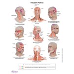 TRATTAMENTO DEI TRIGGER POINTS: UN RIMEDIO CONTRO IL DOLORE – VIRNA ...